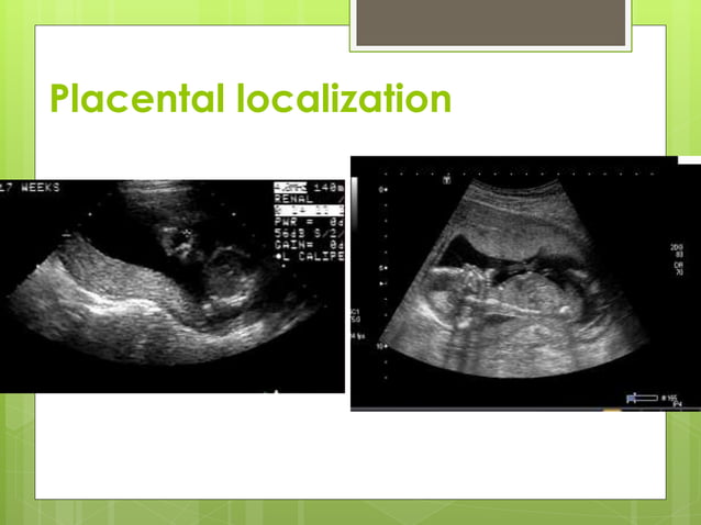 3rd trimester us | PPTX | Pregnancy | Reproductive Health