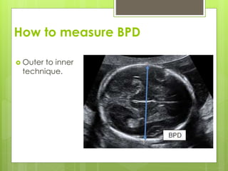 3rd trimester us | PPTX