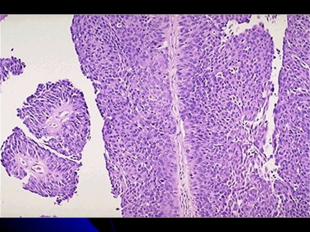 OSPE REVISION PATHOLOGY BDS 2ND YEAR / 3RD YEAR MBBS | PPT | Blood ...