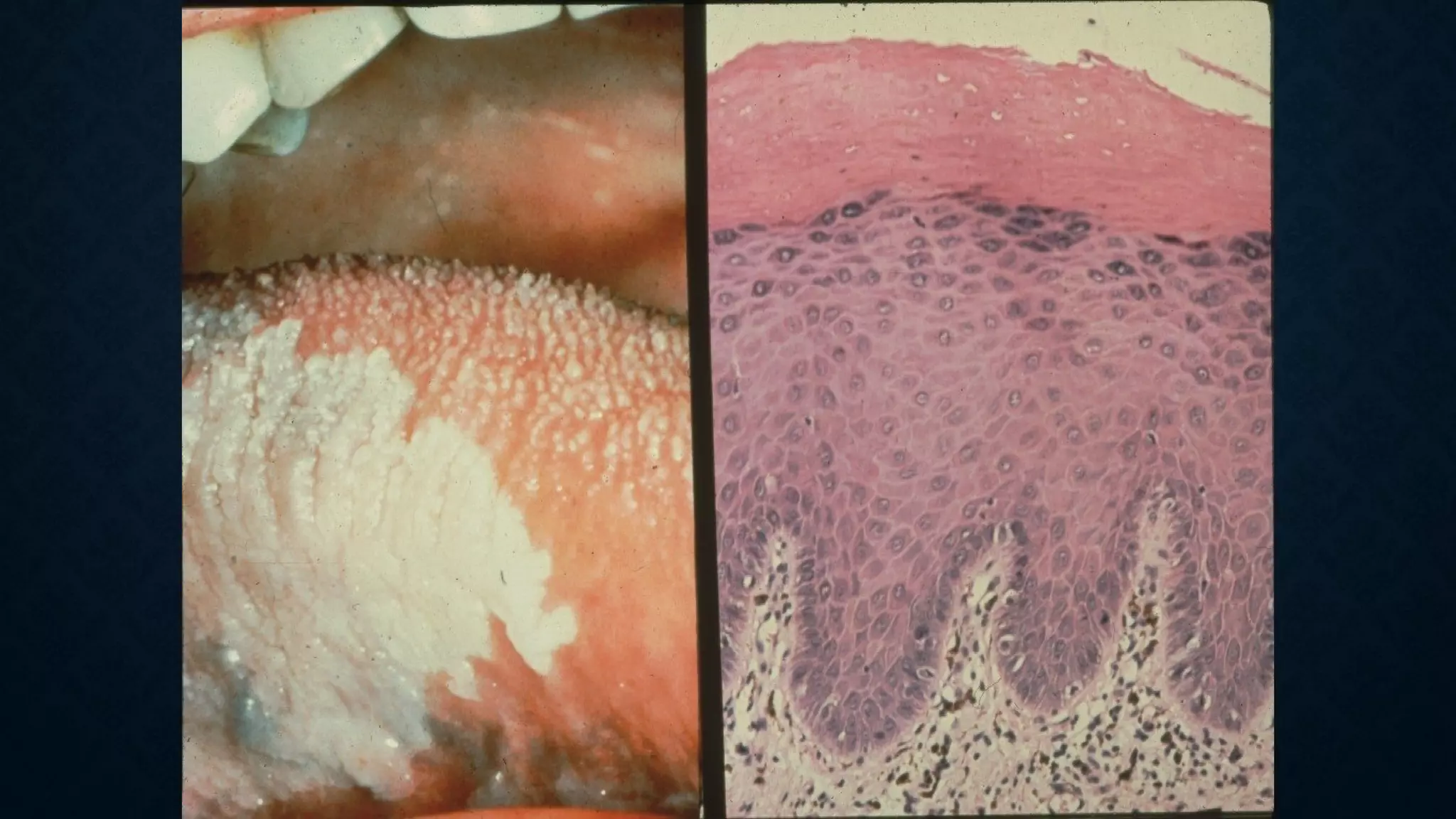 precancerous conditions and lesions | PPT