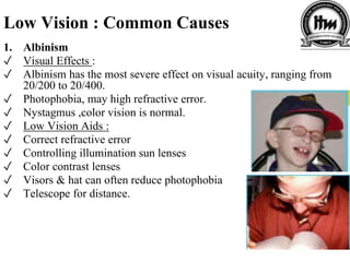 VISUAL AIDS FOR CHILDREN IN LOW VISION AND CONTACT LENS | PPT | Free ...