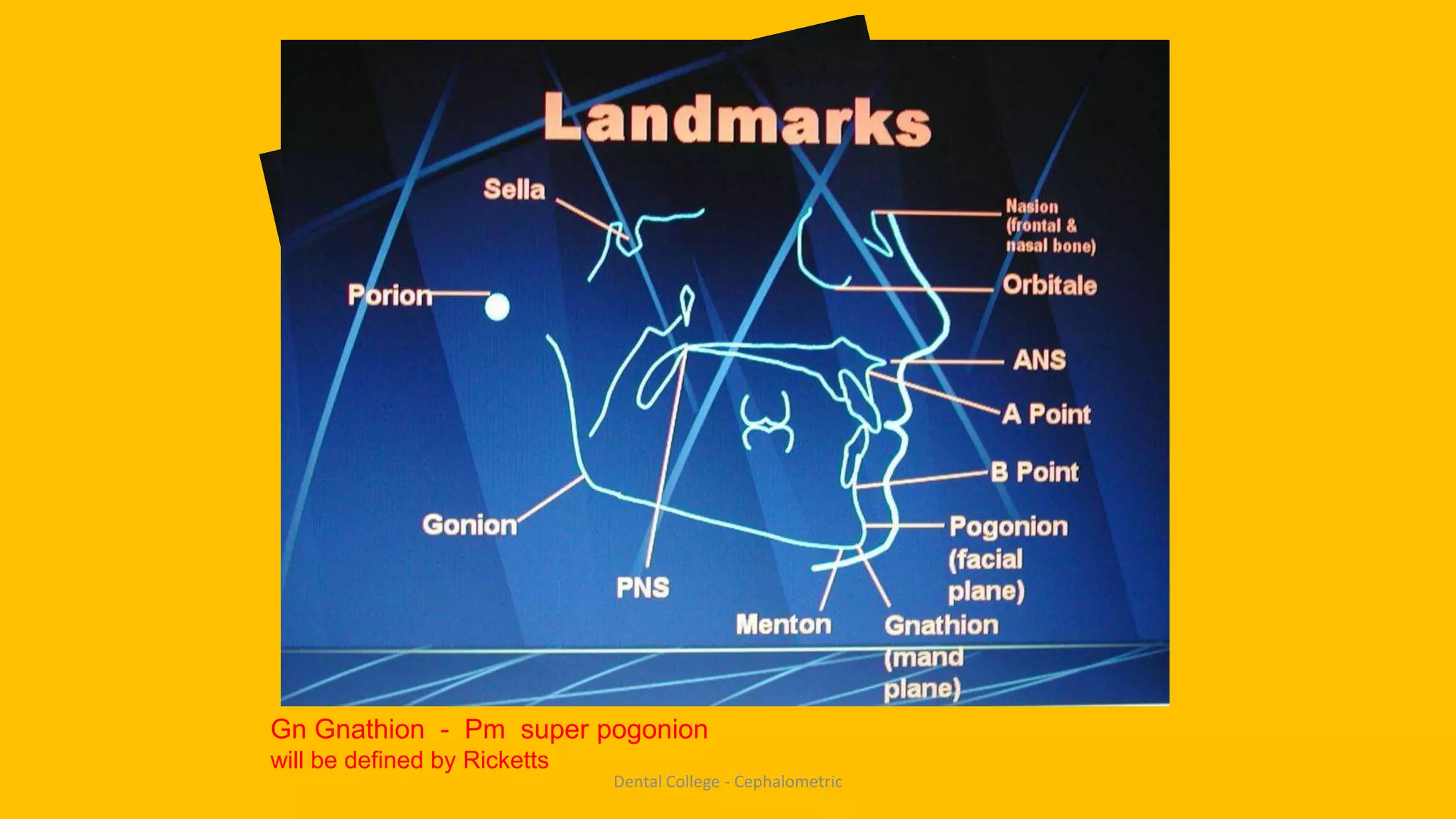 cephalometric 1 : Common points and plans | PPTX
