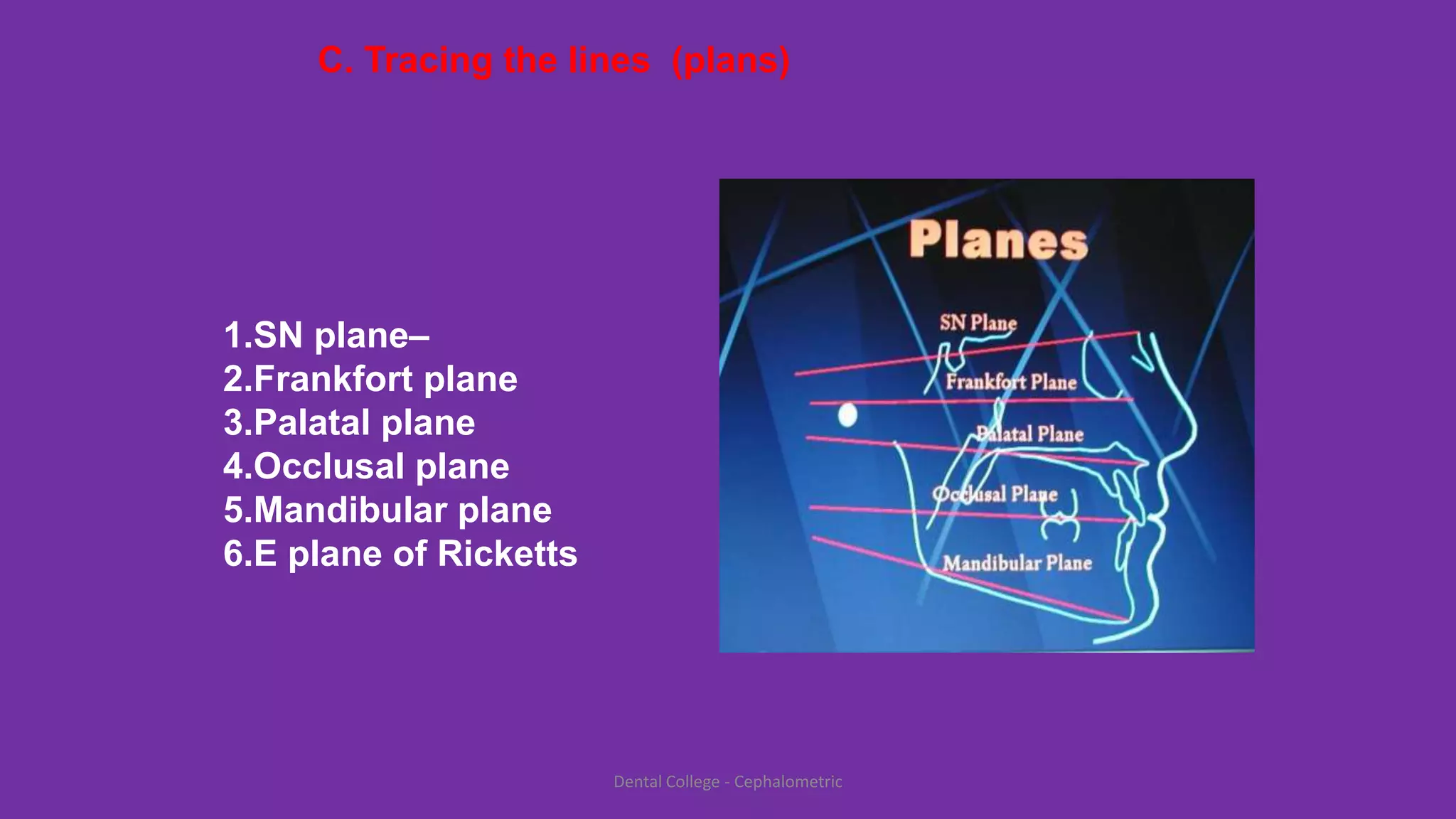 cephalometric 1 : Common points and plans | PPTX