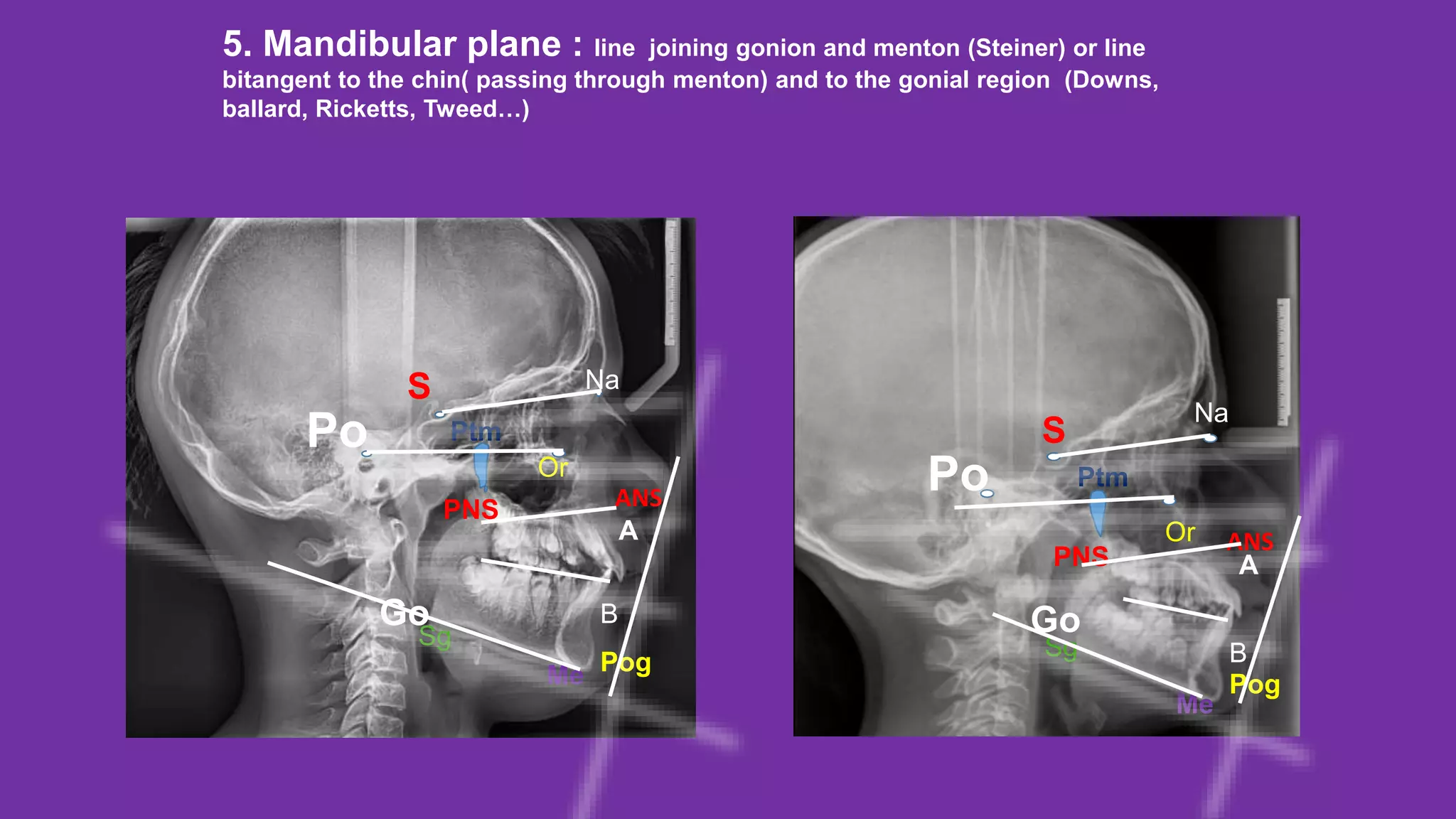 cephalometric 1 : Common points and plans | PPTX