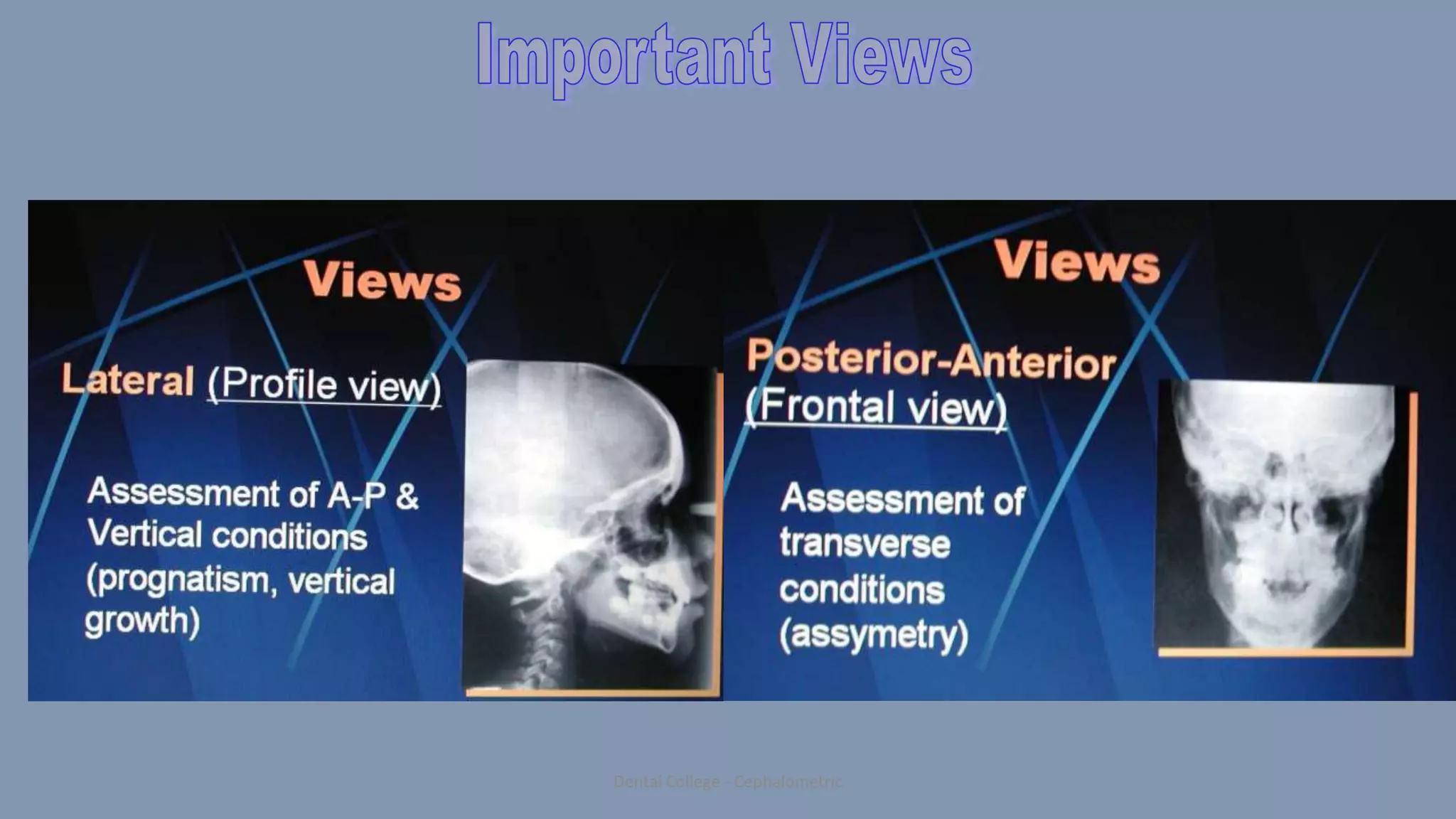 cephalometric 1 : Common points and plans | PPTX
