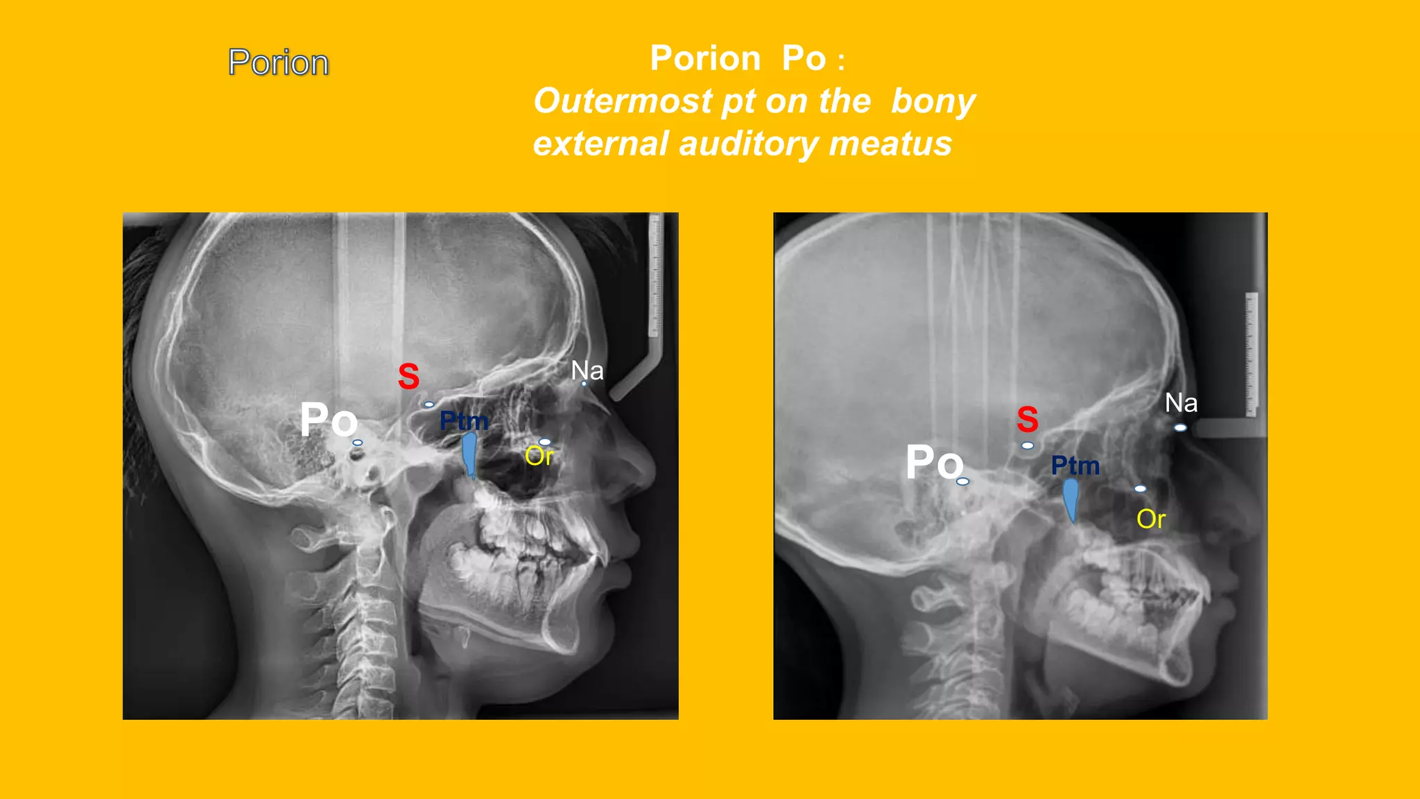 cephalometric 1 : Common points and plans | PPTX