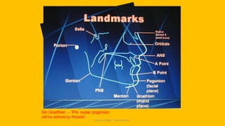 cephalometric 1 : Common points and plans | PPTX