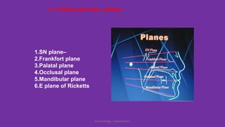 cephalometric 1 : Common points and plans | PPTX