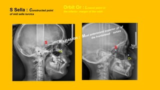 cephalometric 1 : Common points and plans | PPTX