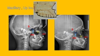 cephalometric 1 : Common points and plans | PPTX