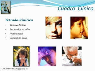 3 rinitis alergica | PPTX