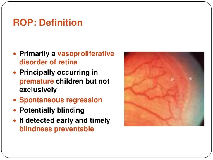 Dr Azad on ROP: Need for training and screening