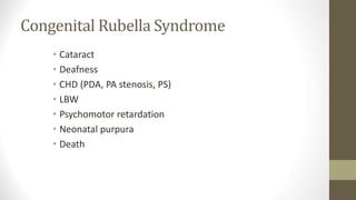 3 Rubella.ppt