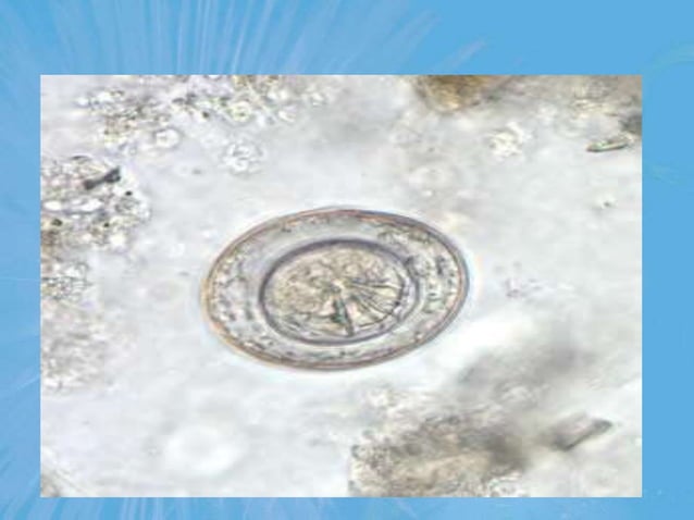 [Micro] hymenolepis nana | PPT