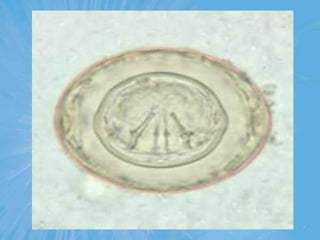 [Micro] hymenolepis nana | PPT