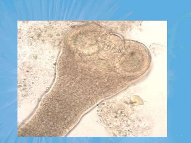 [Micro] hymenolepis nana | PPT