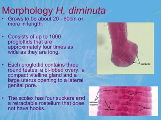 Hymenolepis Diminuta Proglottid