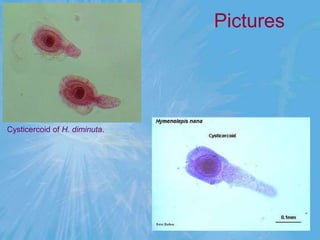 Hymenolepis Diminuta Cysticercoid