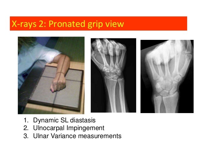 3 common clinical scenarios leading to wrist arthroscopy. Alexandropo…