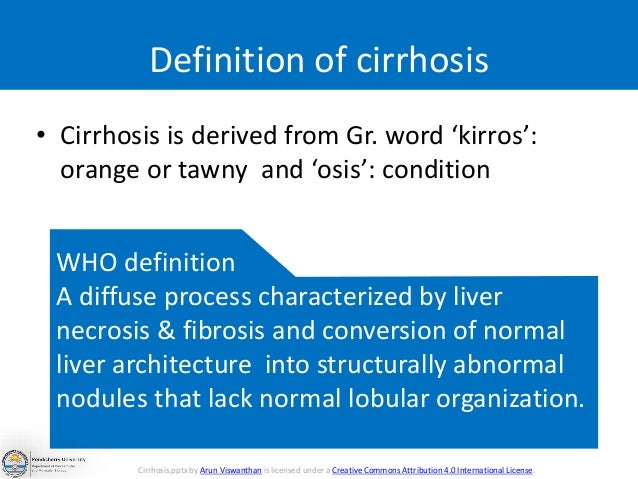Cirrhosis - causes, symptoms, diagnosis, management