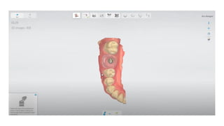 3 shape scanner.pdf | Dental Health | Diseases and Conditions