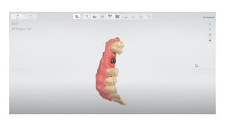 3 shape scanner.pdf | Dental Health | Diseases and Conditions