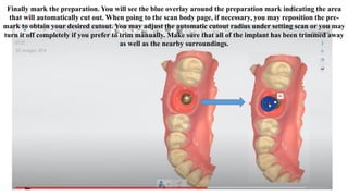 3 shape scanner.pdf | Dental Health | Diseases and Conditions