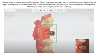 3 shape scanner.pdf | Dental Health | Diseases and Conditions