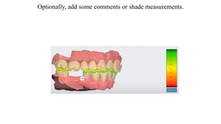 3 shape scanner.pdf