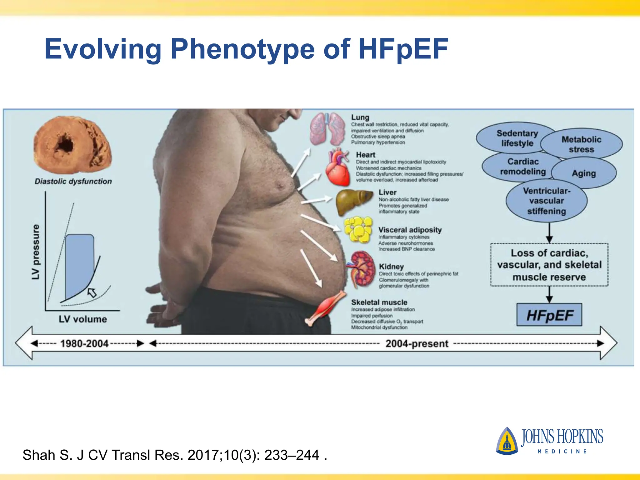 Heart Failure with Preserved Ejection Fraction: Diagnostic Updates | PPTX