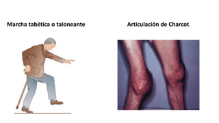 3 Síndromes Sensitivos.pdf