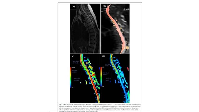 functional MRI Spinal Cord Tractography.pptx