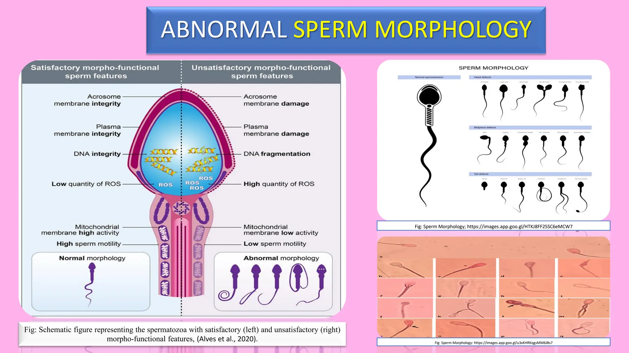 Structure of Sperm / Spermatozoon .pdf