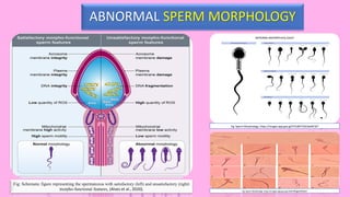 Structure of Sperm / Spermatozoon .pdf