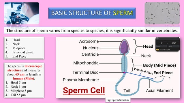 Structure of Sperm / Spermatozoon .pdf | Infertility | Reproductive Health