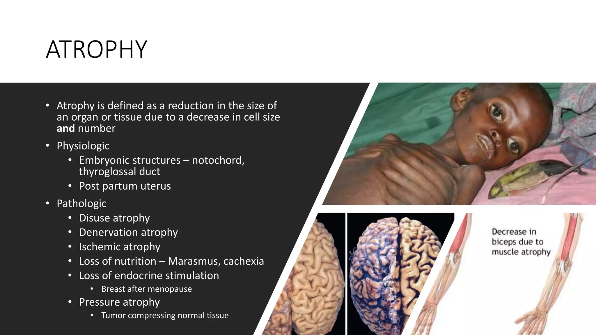 Ch 2 adaptations, cell injury, cell death | PPTX