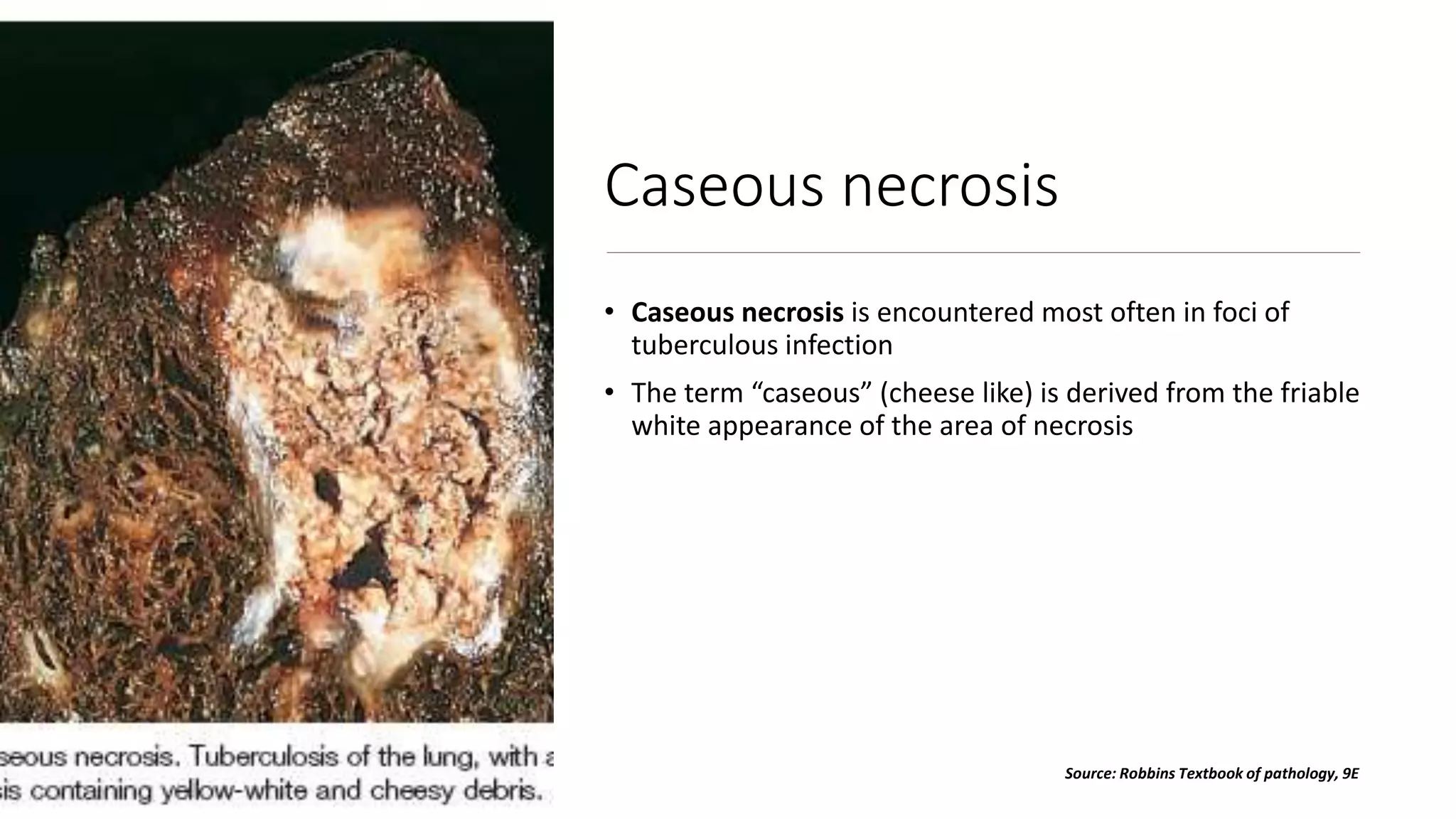 Ch 2 adaptations, cell injury, cell death | PPTX