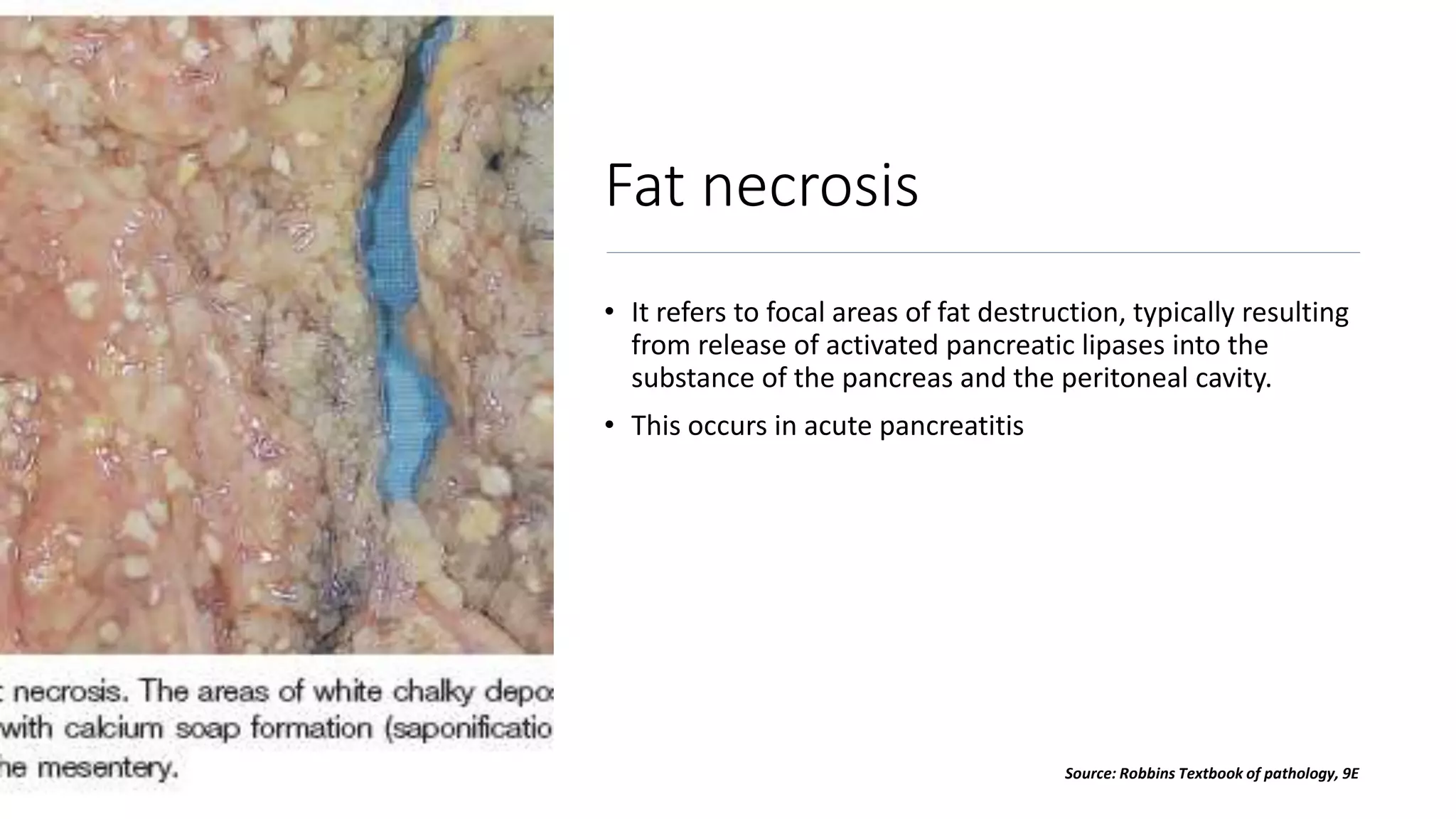Ch 2 adaptations, cell injury, cell death | PPTX