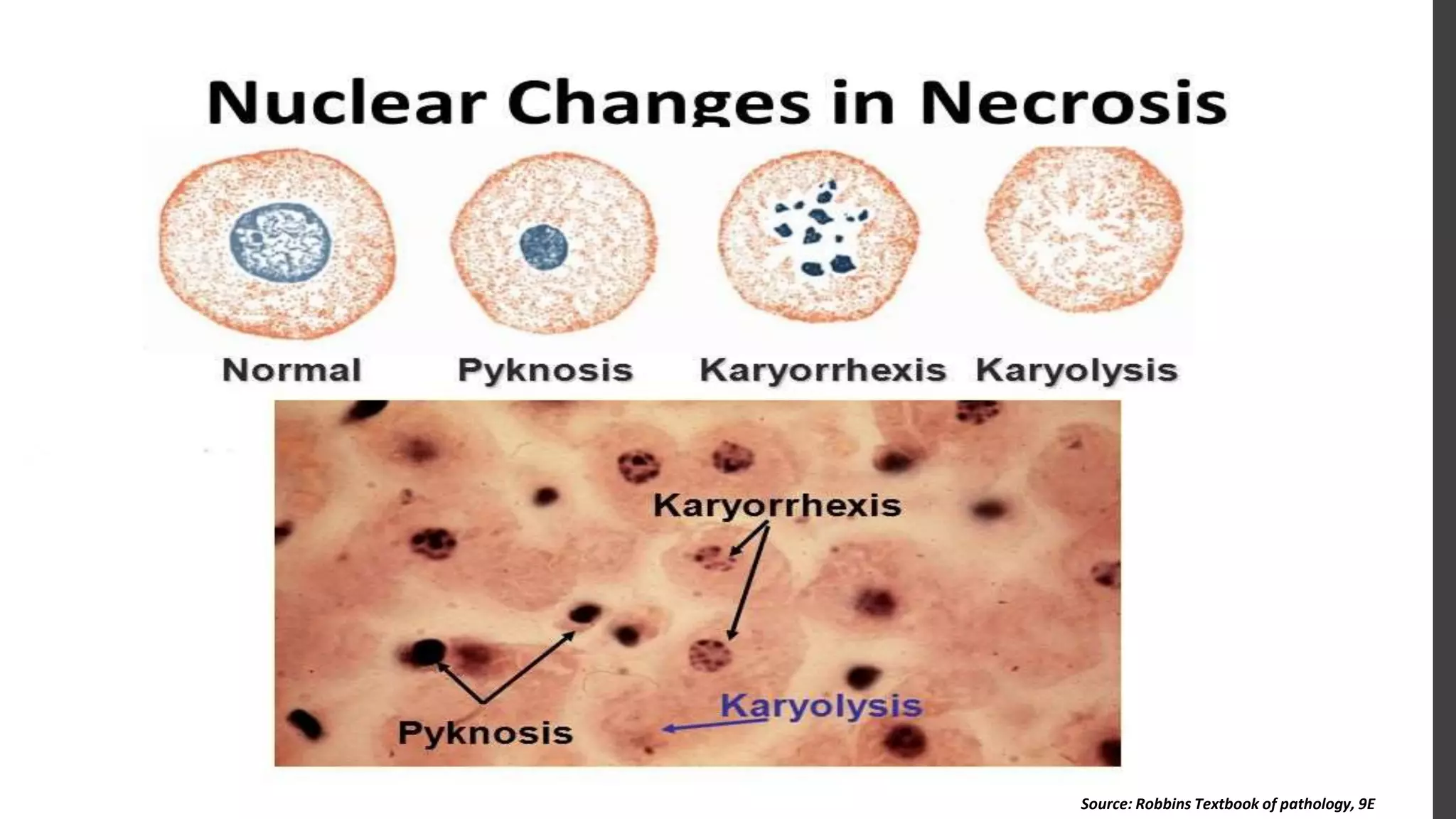 Ch 2 adaptations, cell injury, cell death | PPTX