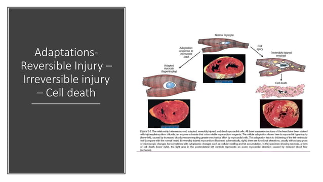 Ch 2 adaptations, cell injury, cell death | PPTX | Endocrine and ...