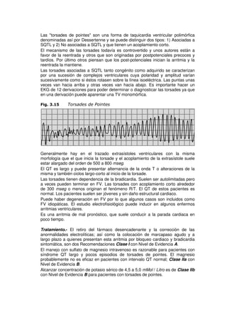 Taquiarritmias irregulares QRS ancho | PDF
