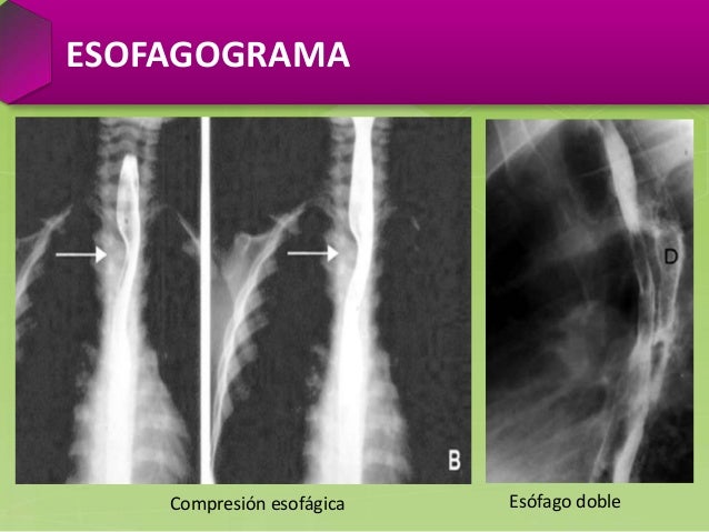 Tecnicas radiologicas especiales