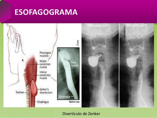 Tecnicas radiologicas especiales
