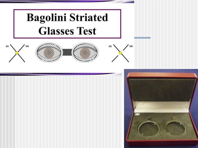 3 Tests for Binocular Single Vision | PPT