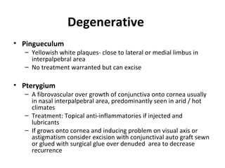 Conjunctiva | PPT | Eye and Vision Conditions | Diseases and Conditions