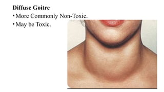 3) Thyroidectomy with all associated notes.pptx