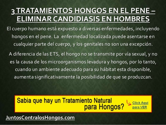 3 tratamientos hongos en el pene – eliminar candidiasis en hombres