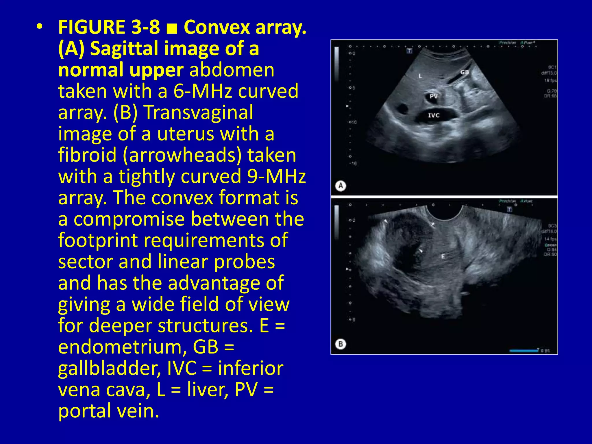 3 ultrasound Ultrasound Physics Garringer and Aliison Dr. Muhammad Bin ...
