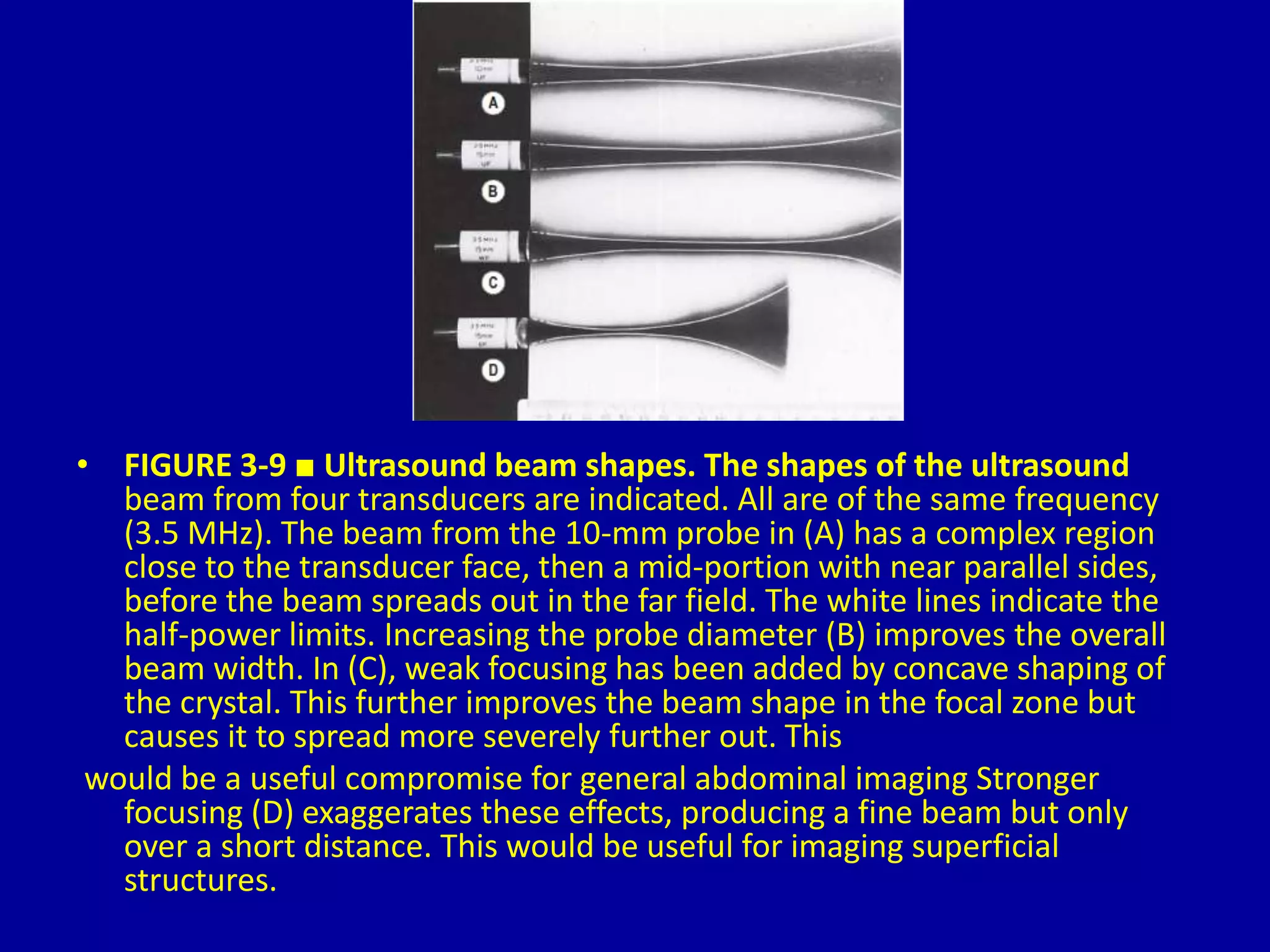 3 ultrasound Ultrasound Physics Garringer and Aliison Dr. Muhammad Bin ...