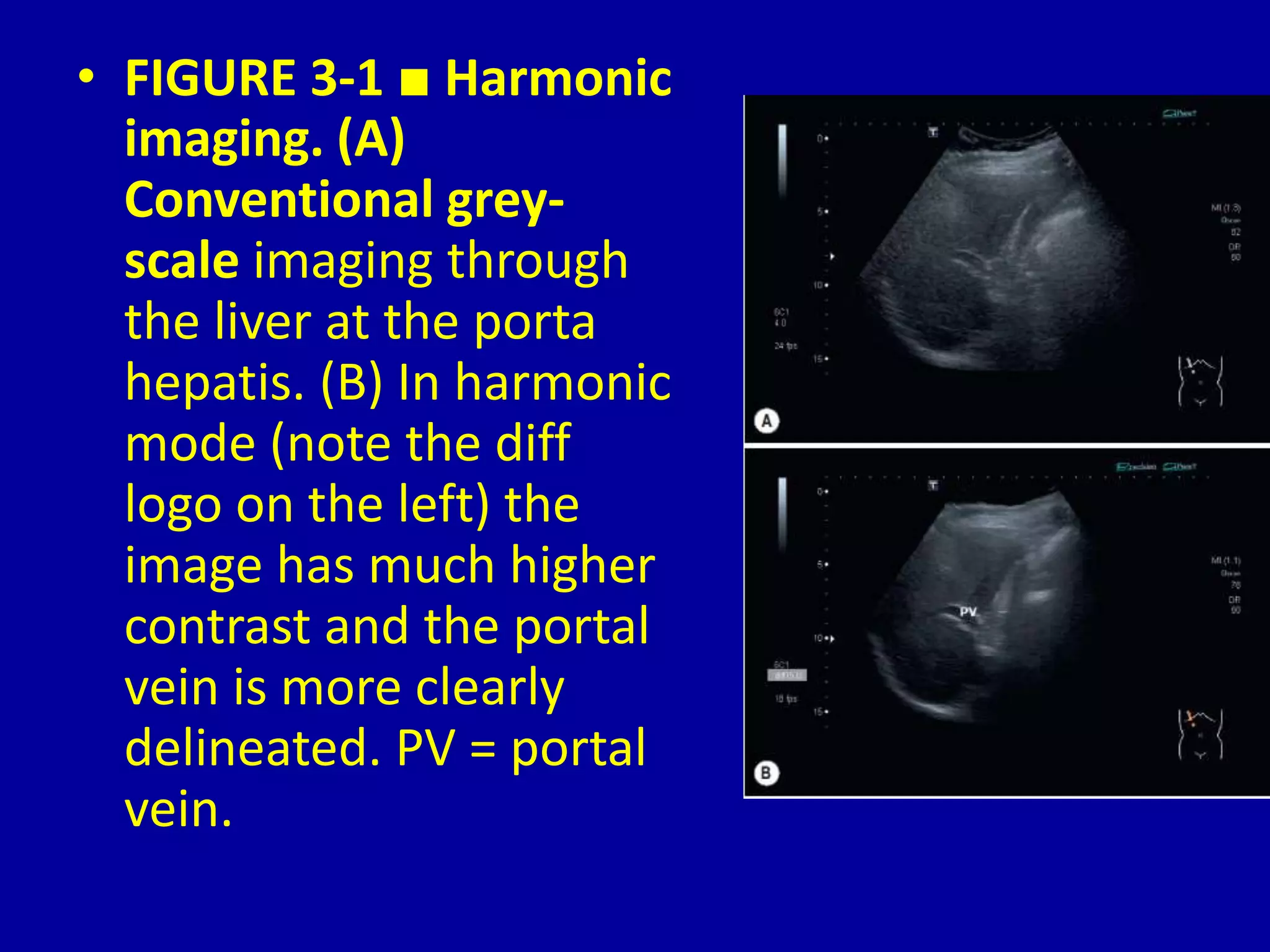3 ultrasound Ultrasound Physics Garringer and Aliison Dr. Muhammad Bin ...